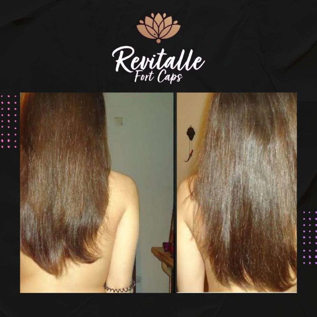 Revitalle Fort Caps® – Site Oficial