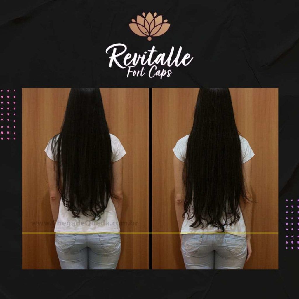 Revitalle Fort Caps® – Site Oficial