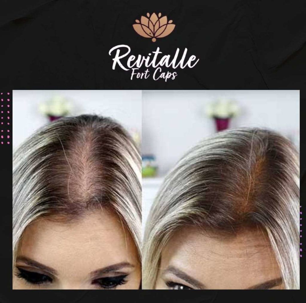 Revitalle Fort Caps® – Site Oficial